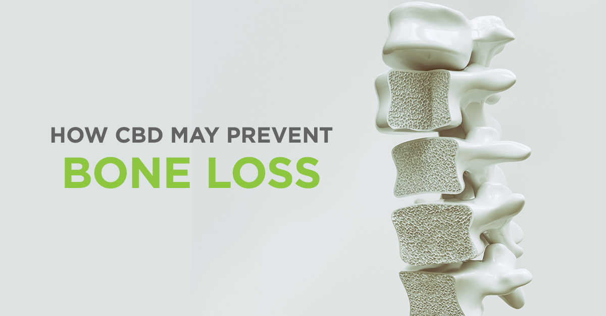 CBD and Osteoporosis - A Meaningful Application For Bone Health?