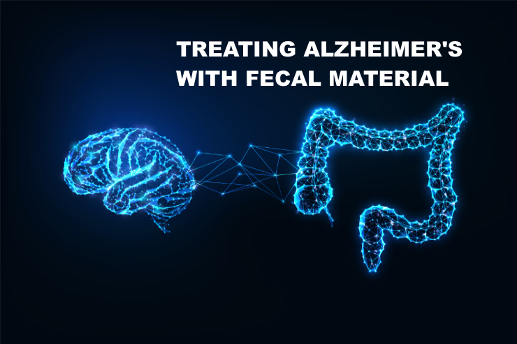 Treating Alzheimer's with Fecal Material - David Perlmutter M.D.